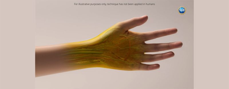 New Technique Makes Skin Transparent | Mirage News