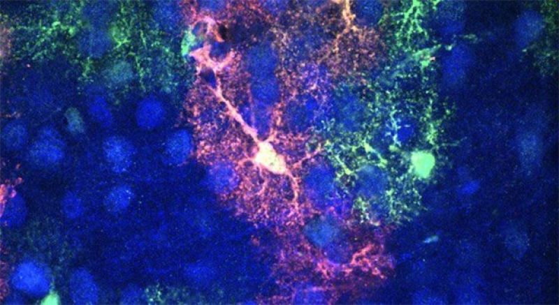 Healthy sleep may rely on long-overlooked brain cells | NSF - U.S ...