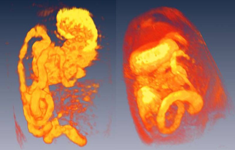 Gut Reaction: Digestion Revealed in 3-D | NSF - National Science Foundation